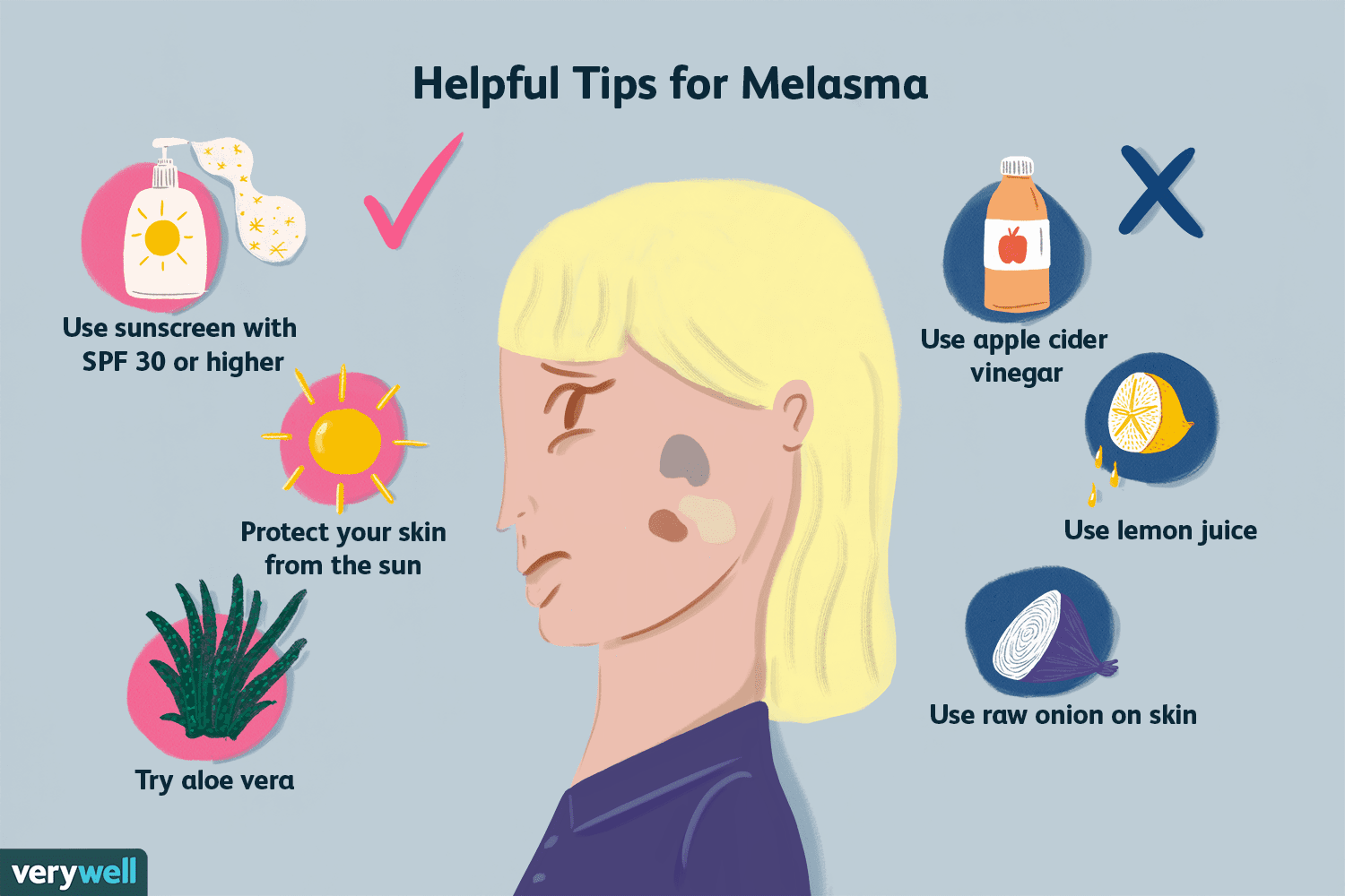 What are some effective treatments for melasma? - MyMedicPlus