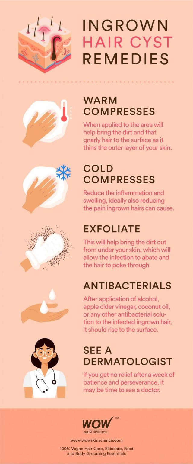 How can I prevent and treat ingrown hairs? - MyMedicPlus