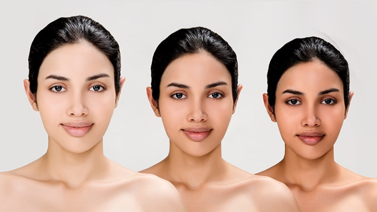 What is Skin whitening & how its getting done? - MyMedicPlus